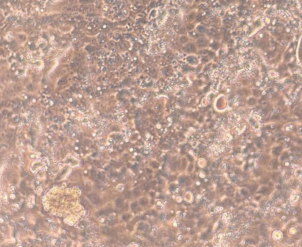 The Epithelial to Mesenchymal Transition (EMT) - BASIS Phoenix